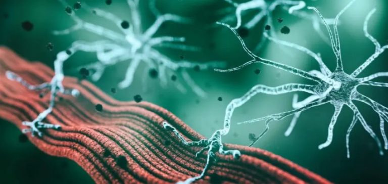 Un essai clinique au Neuro donne espoir sur un traitement possible de ...